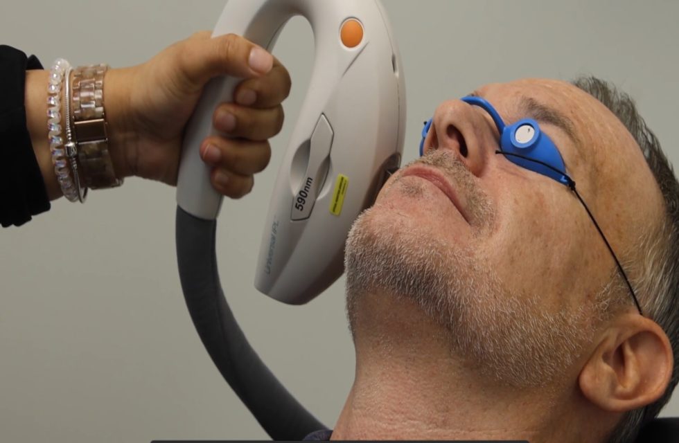 IPL Therapy for Dry Eye Relief | Your Eye Institute in NC